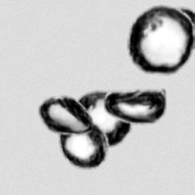 BubANN_GAN Instance Segmentation Dataset by University Project