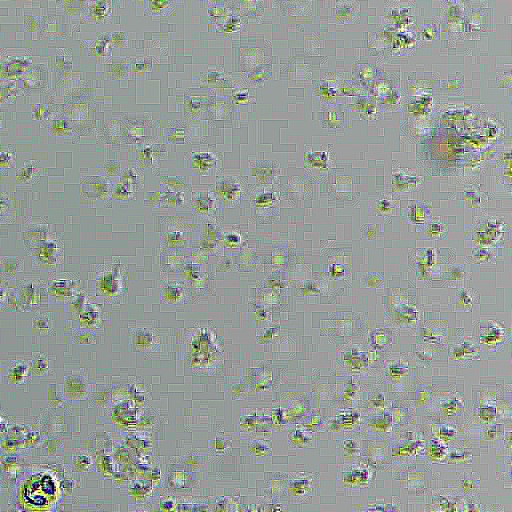 WBC Images (blurry) Object Detection Dataset by Urinalysis