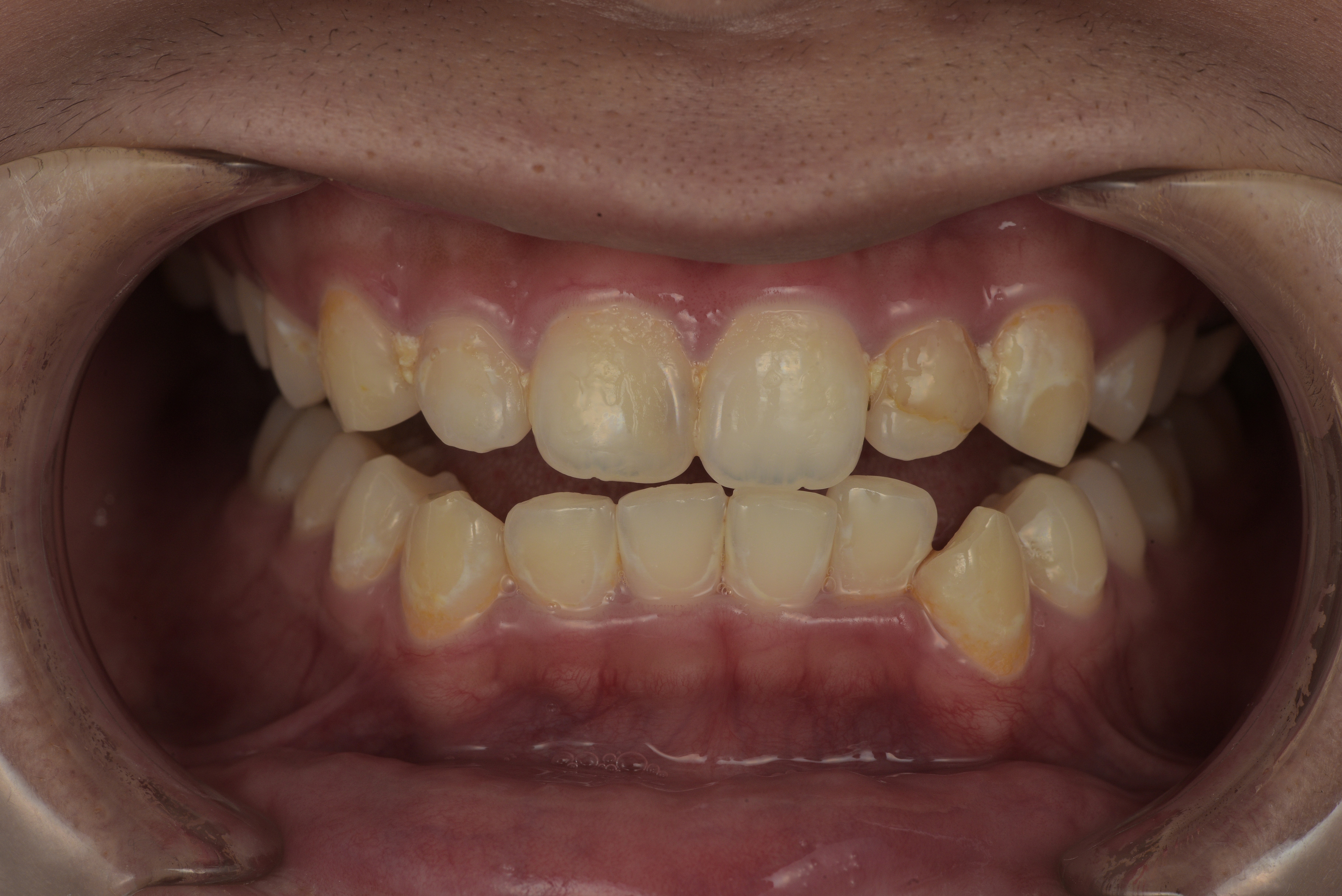 Oral Object Detection Model by tempest