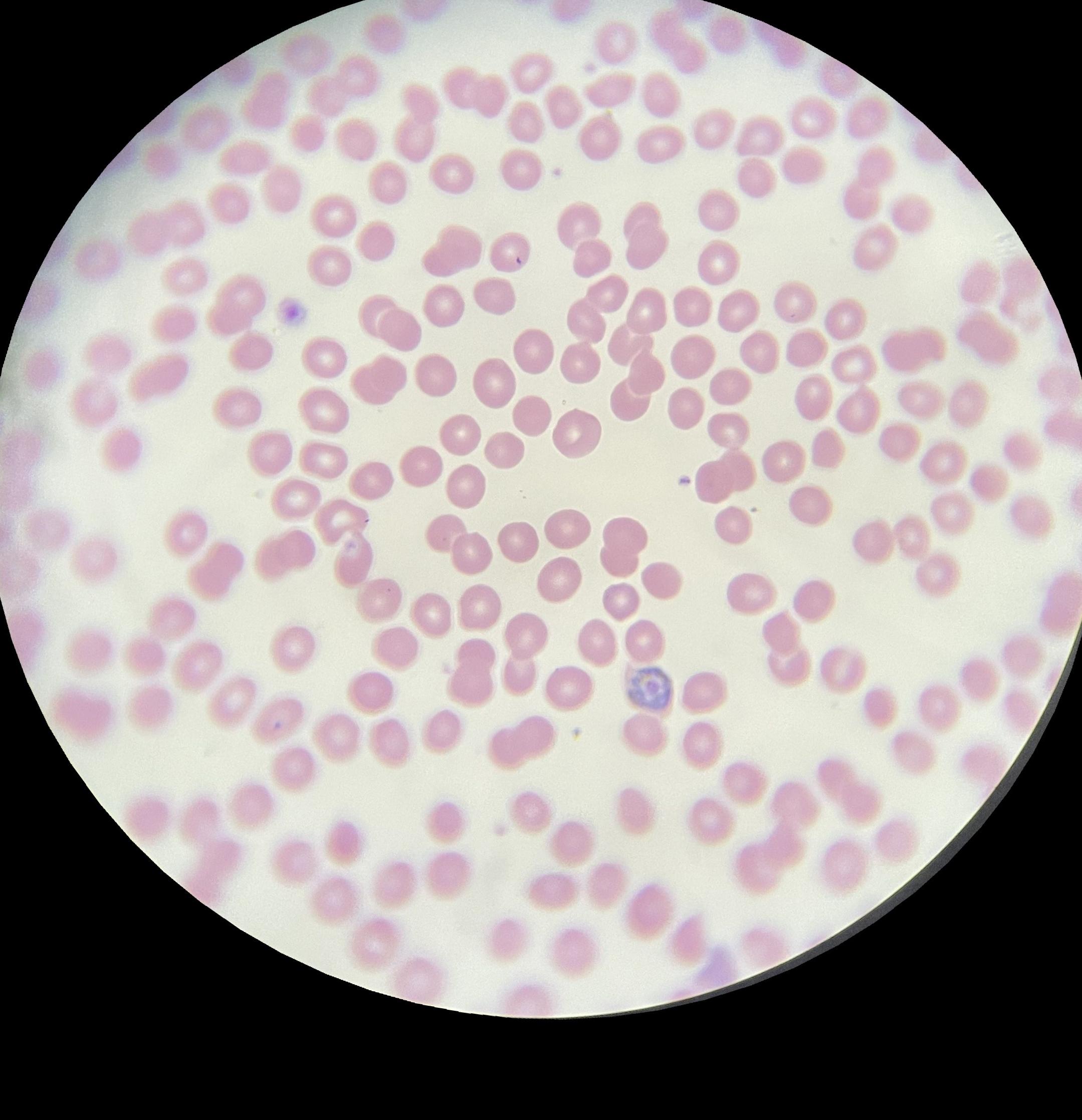 Parasite classification Object Detection Model by Sci Fair Classification