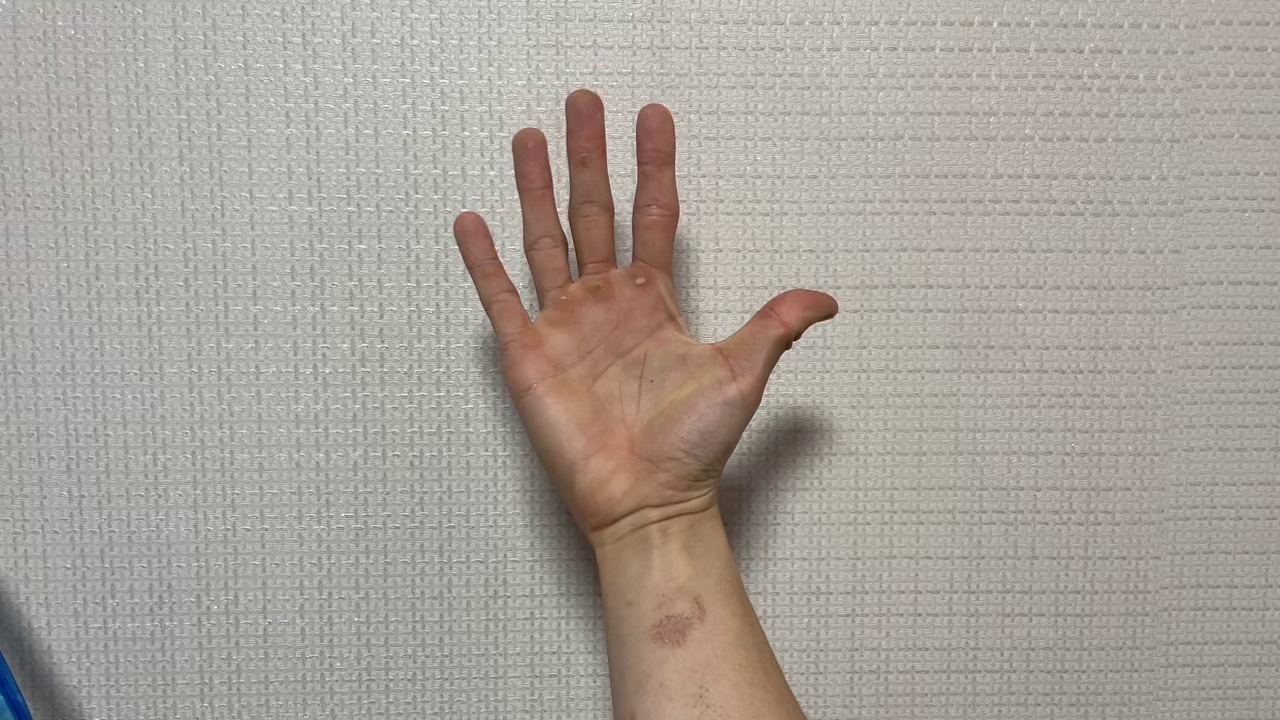 hand_v2 Object Detection Dataset by project-fgv4d