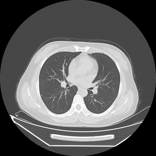 Ahique_Lung_Segmentation Instance Segmentation Dataset by Khulna University of Engineering and ...