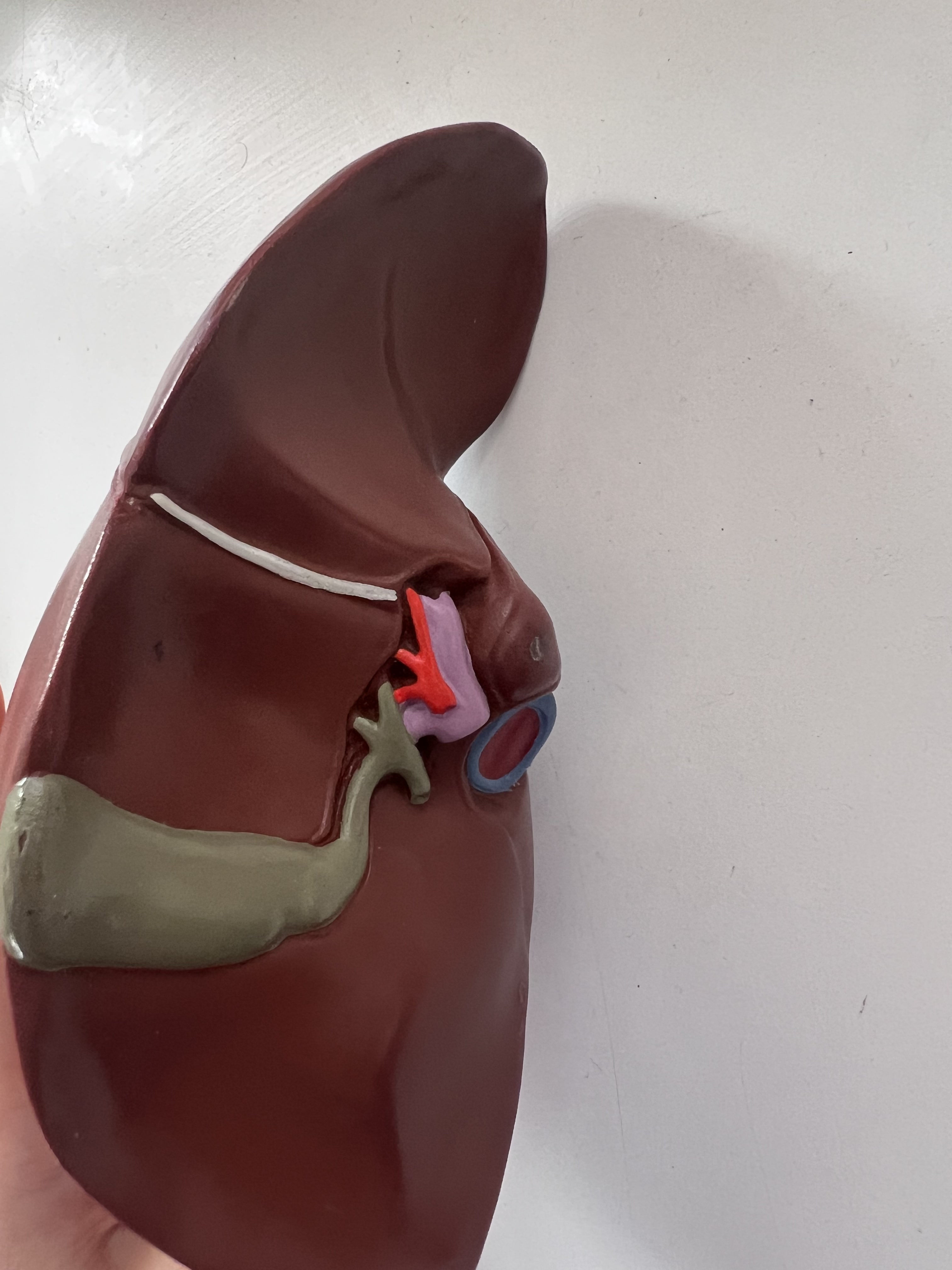 Medical Object Detection Roboflow Universe