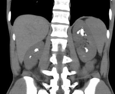 object_detection Object Detection Model by Object
