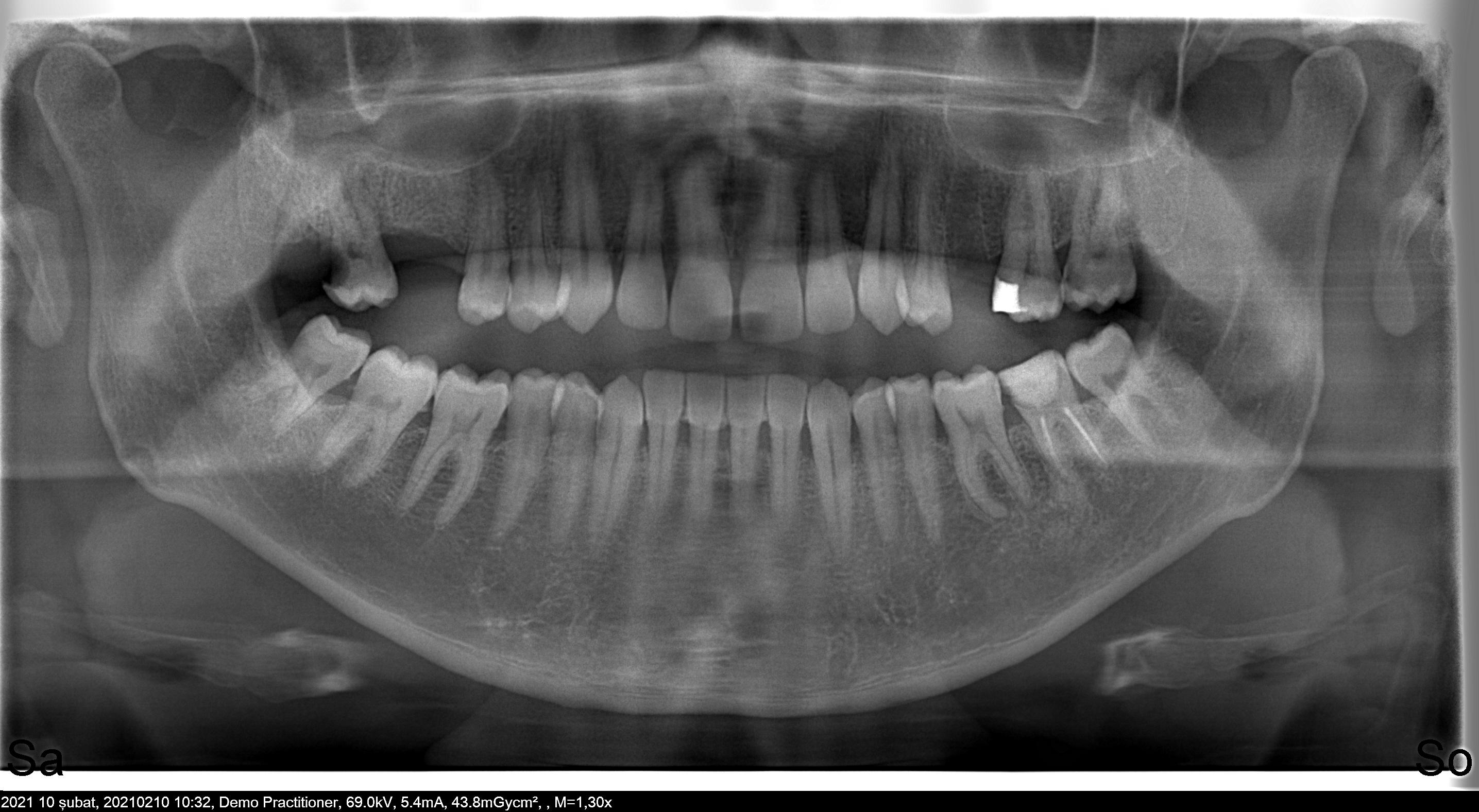 ddd Object Detection Model by ds