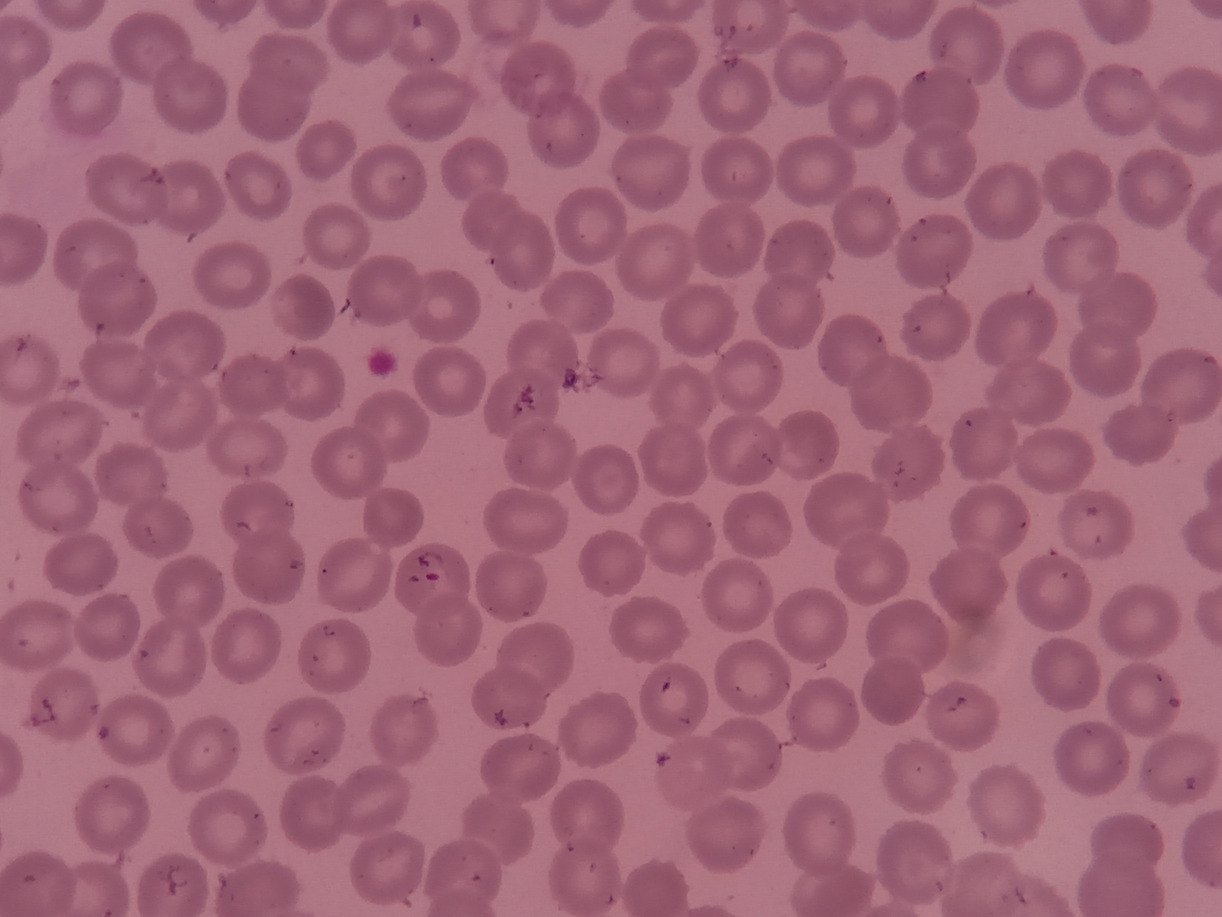 Malaria Object Detection Dataset by school