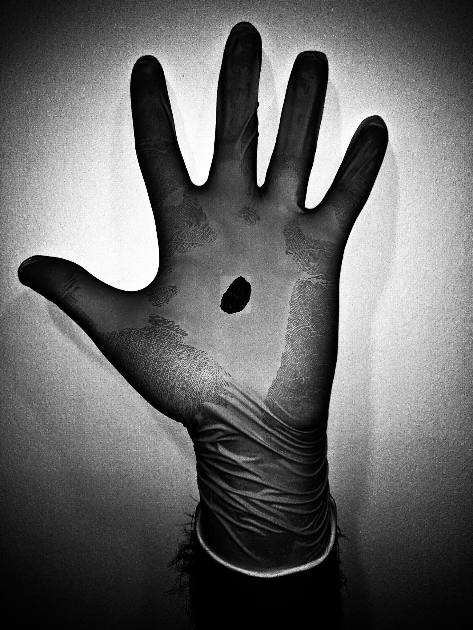 Glove Defect 2 Instance Segmentation Dataset And Pre Trained Model By Glove Defect