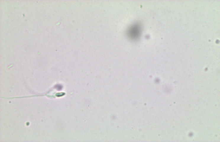 sperm Object Detection Model by project-vxfjt