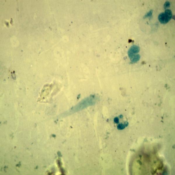 Nyoba Dataset Untuk CV2 Object Detection Dataset by Blessvalenta Masniari