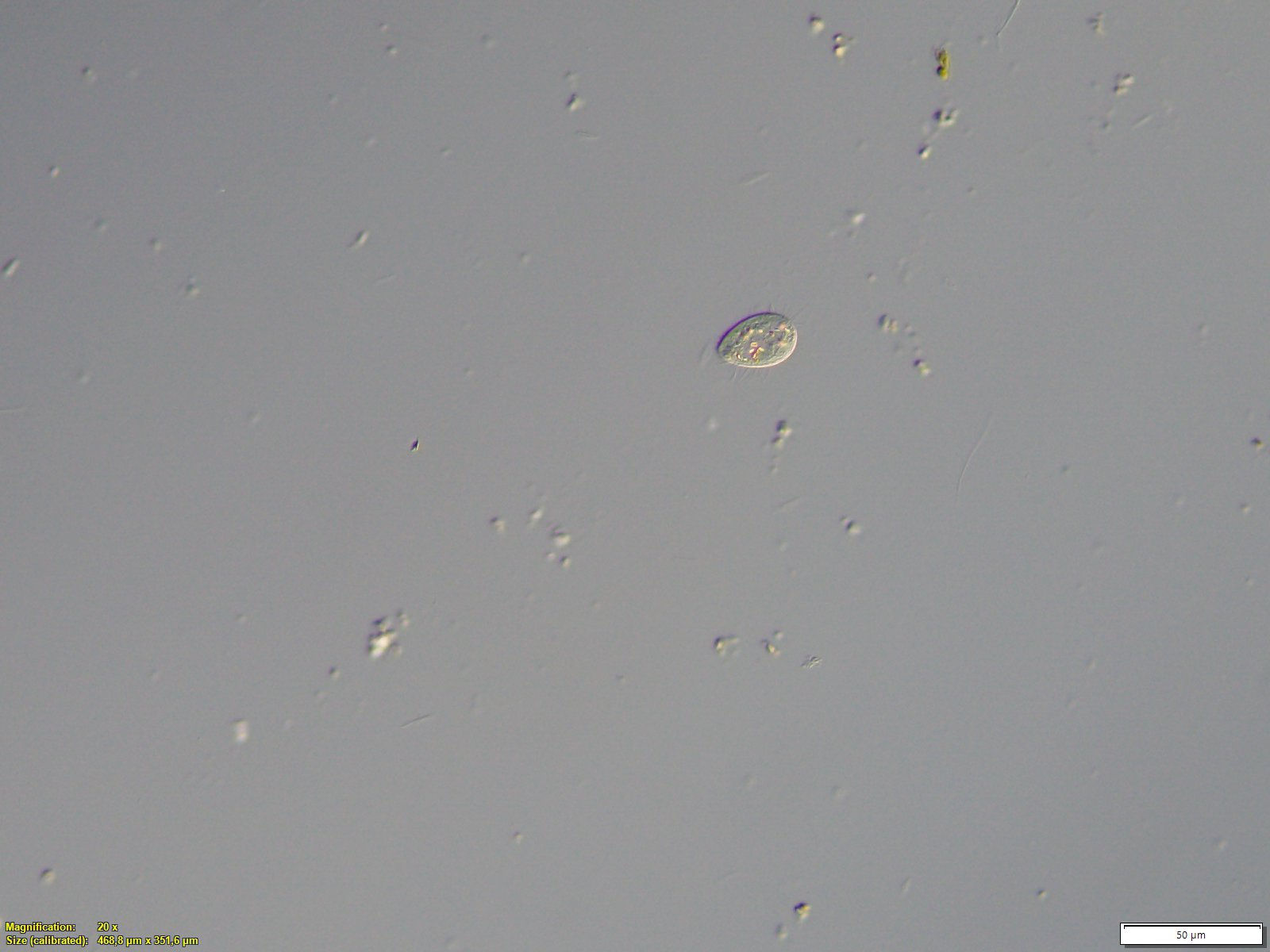 Algae_processed_blackboxes Object Detection Dataset by Stuff