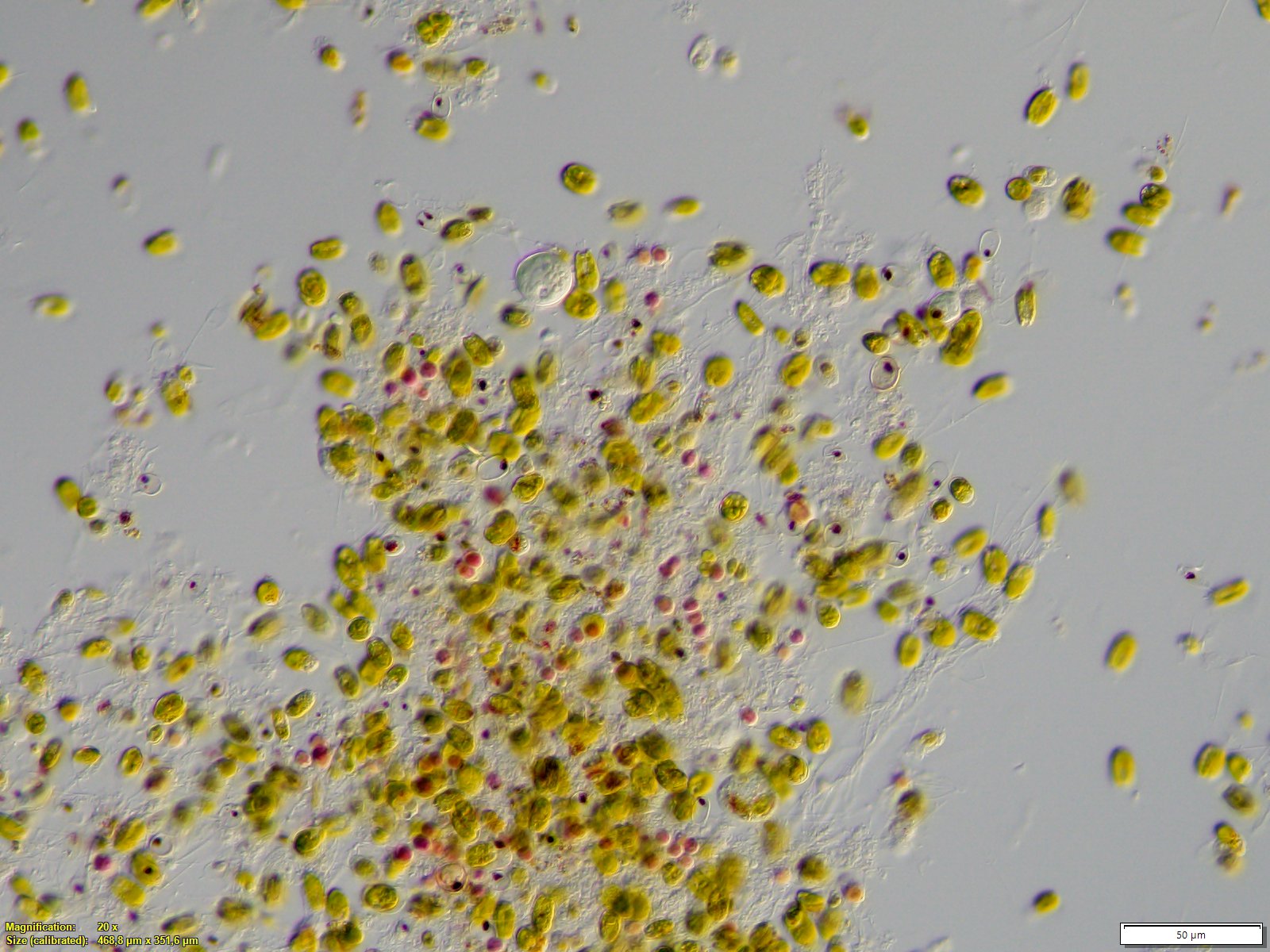 Algae_Original Object Detection Dataset by Stuff