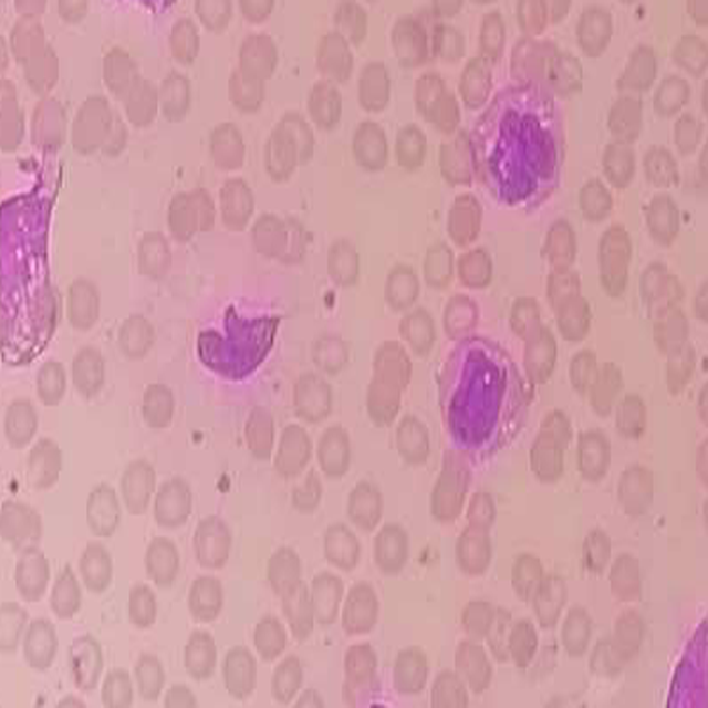 coco json Object Detection Dataset by Object Detection