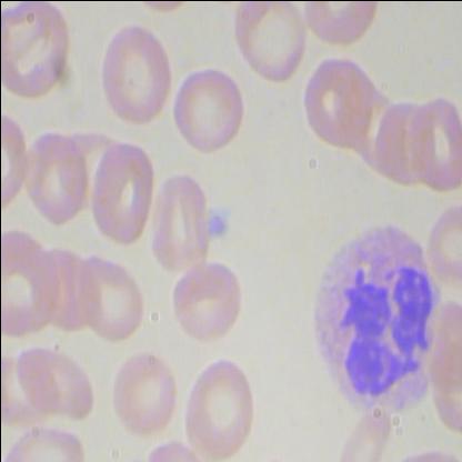 BCCD Object Detection Dataset and Pre-Trained Model by Personal