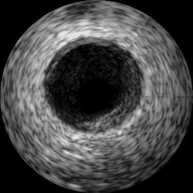 MY-SEG Object Detection Dataset and Pre-Trained Model by bunny