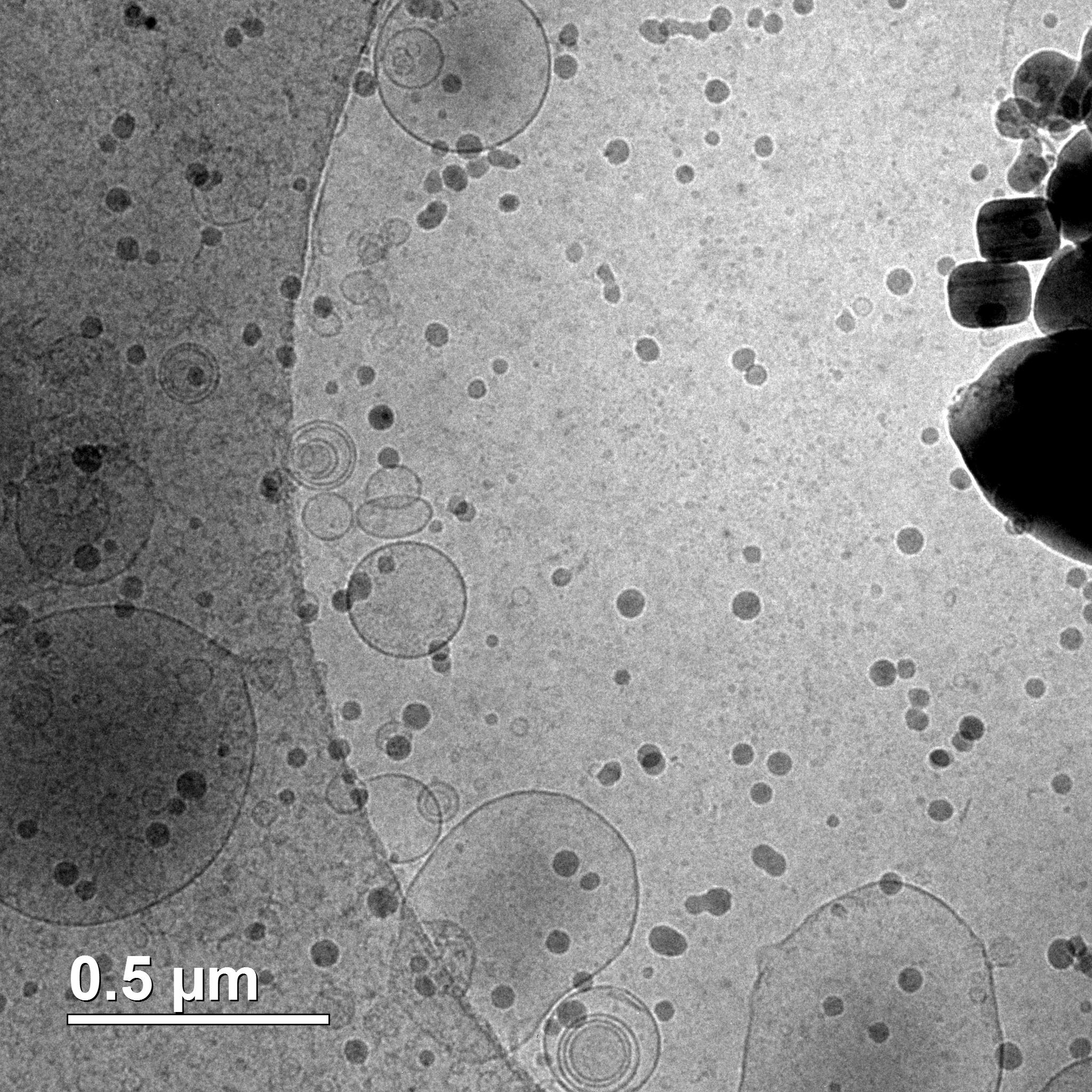 Cryotem Evs Roboflow Universe