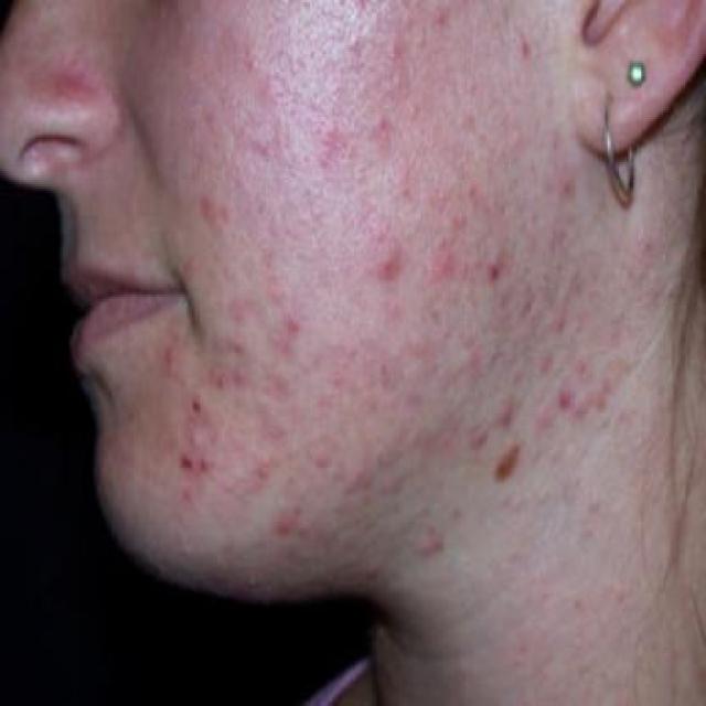 wrin - Roboflow Universe