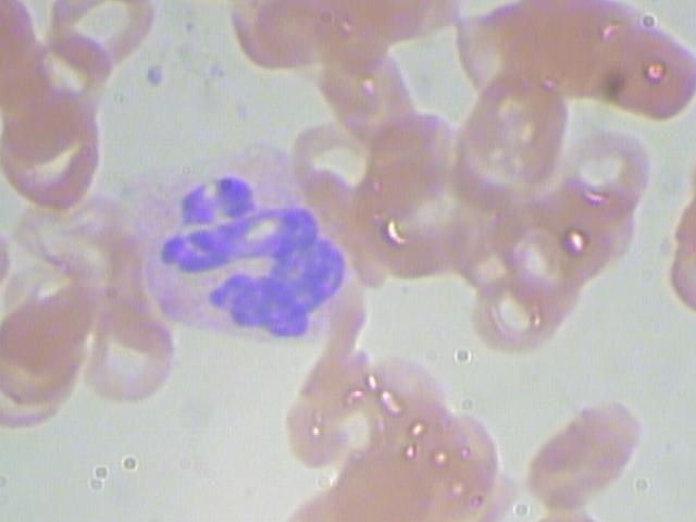 blod celss Object Detection Dataset by Andreas