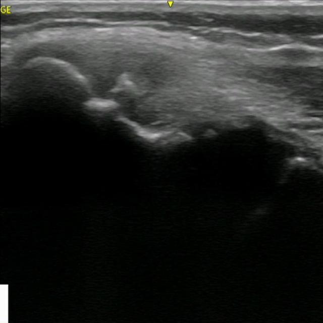 How to Use the ME detection for JSOA ver1 Object Detection API