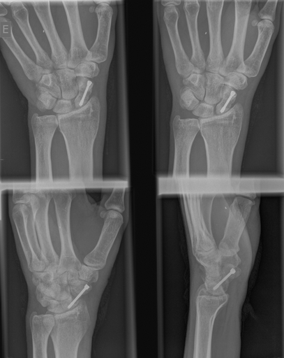 x-ray Object Detection Dataset by TalZ