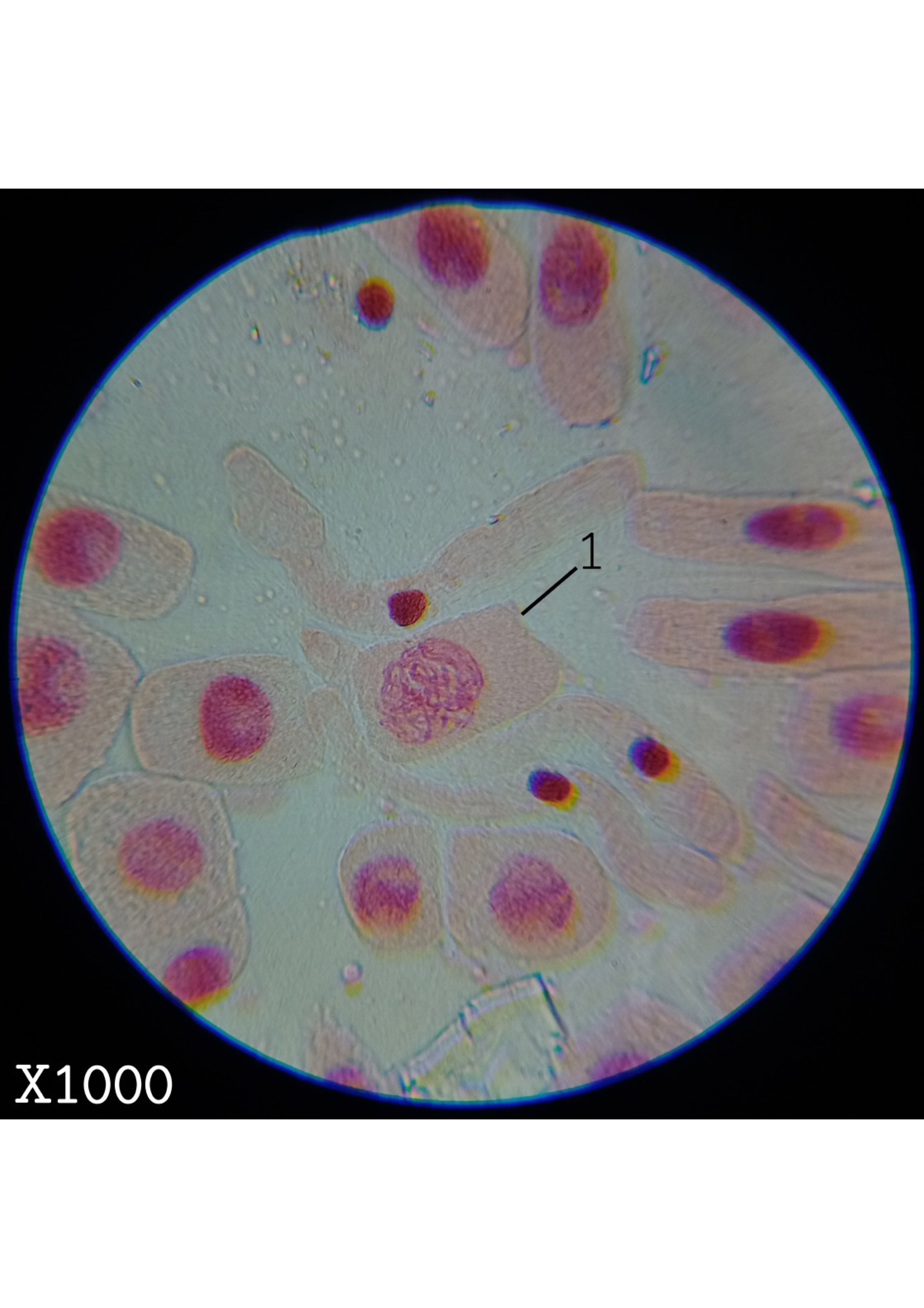 Mitosis Object Detection Dataset By Pccm
