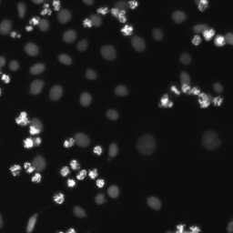 pooja muley_nuclei Semantic Segmentation Dataset and Pre-Trained Model ...