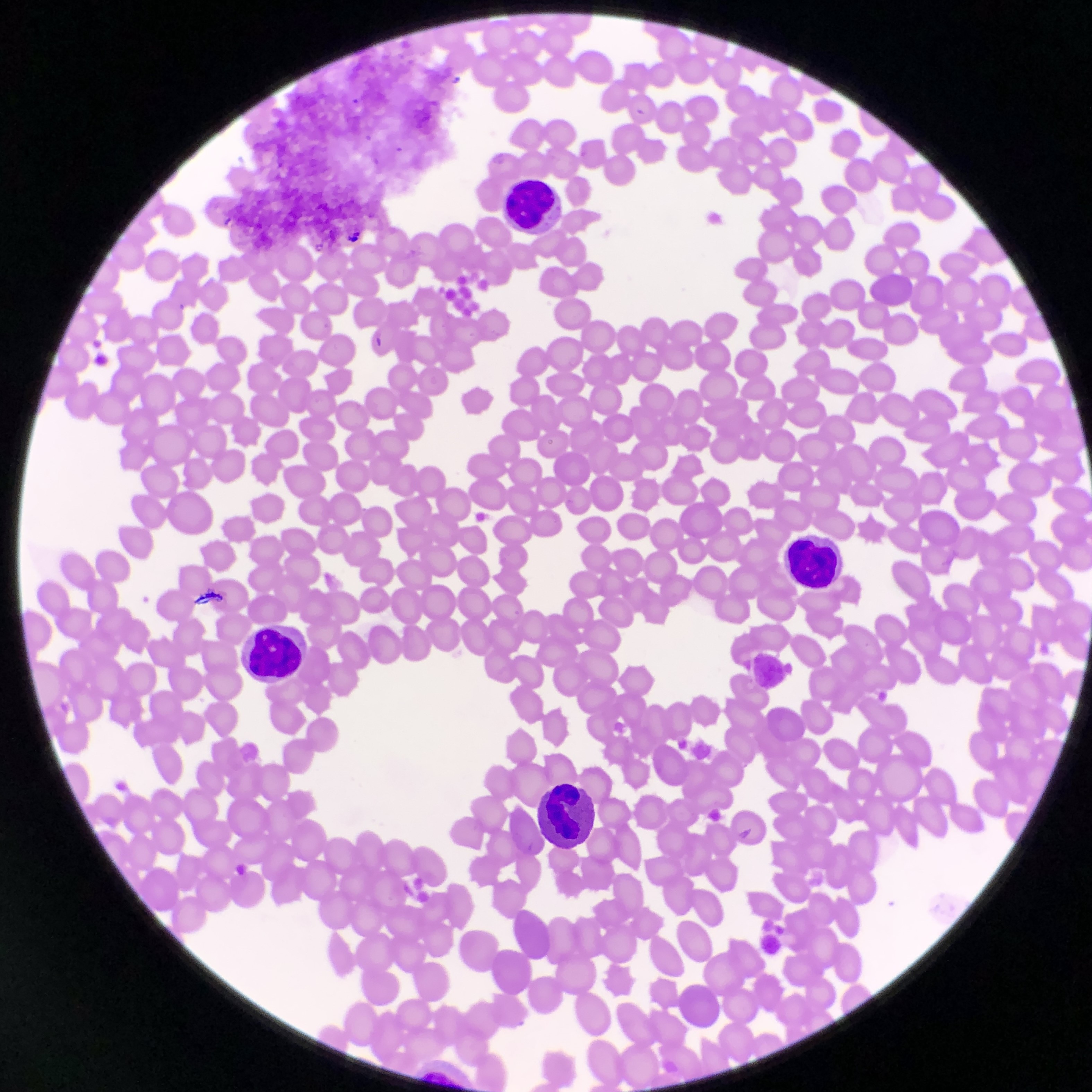 Blood cell anotation Object Detection Dataset by Jacqueline Rose Alipo-on