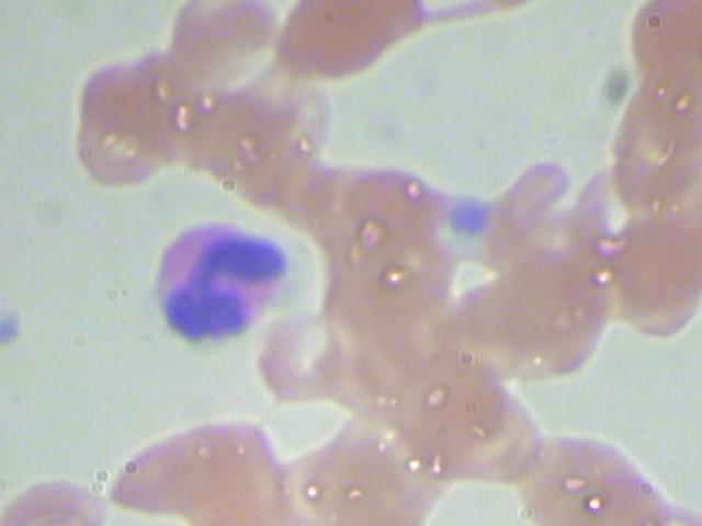 Platelet Count Object Detection Dataset And Pre Trained Model By