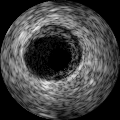 my-seg Instance Segmentation Dataset by mayy
