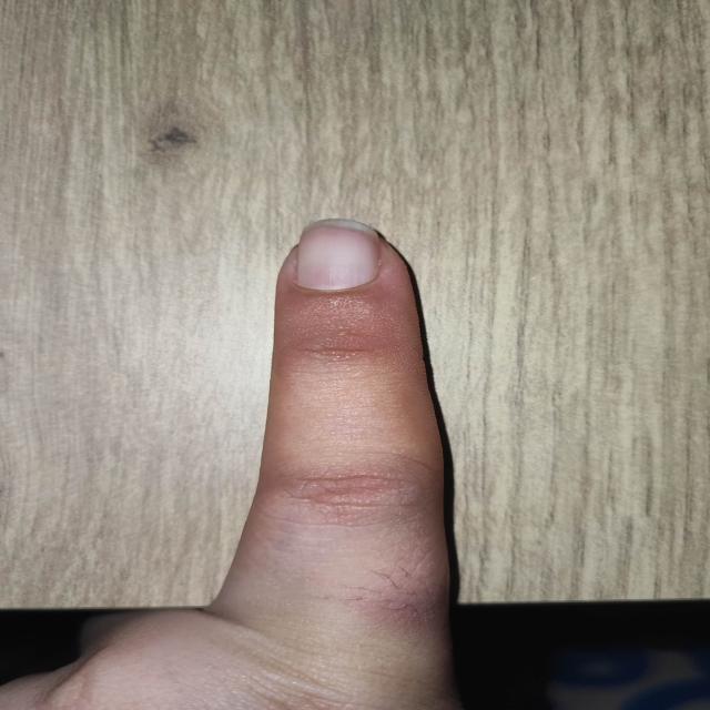 Nail Fit Object Detection Dataset by NailFit