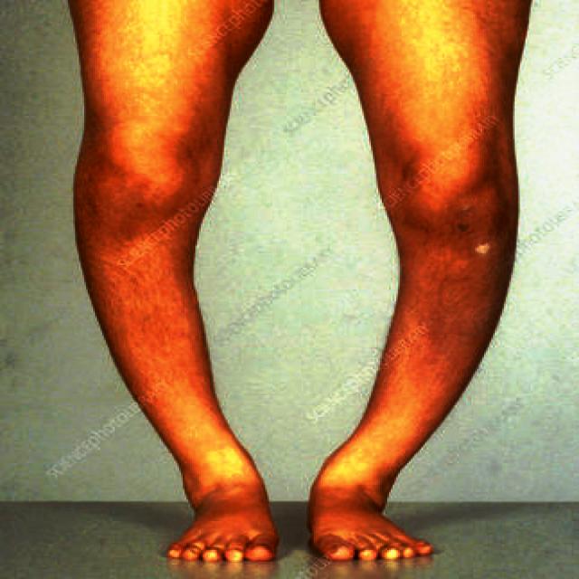 leg detection Object Detection Model by detection