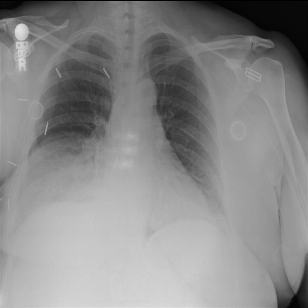 detect X-ray class Semantic Segmentation Dataset by anhsapper