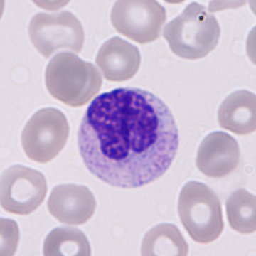Cell Segmentation Project Instance Segmentation Dataset and Pre-Trained Model by Jexa