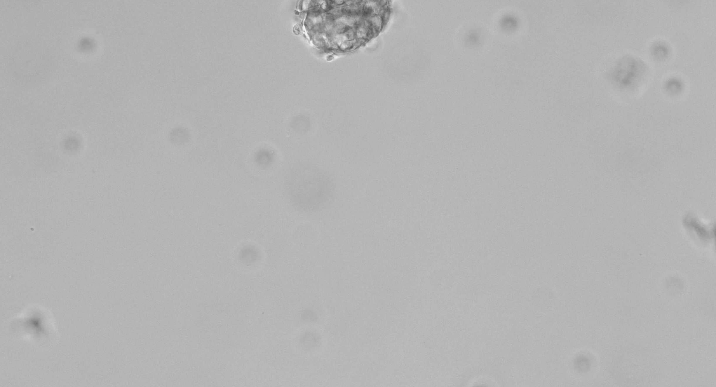 tumor organoids Object Detection Model (v4, 2025-10-13 6:16pm) by Liulab