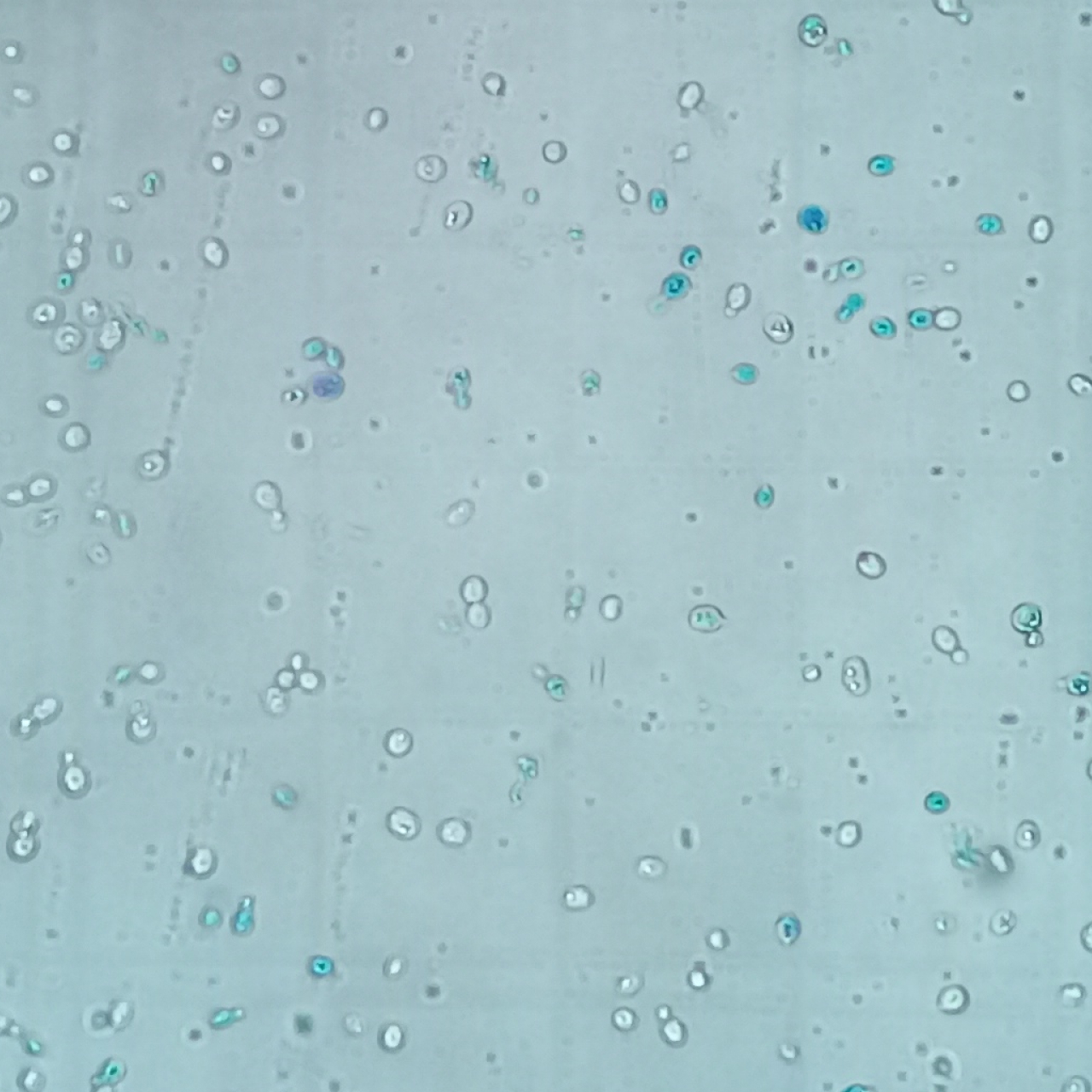 Yeast Counting New Object Detection Dataset by Tugas Akhir Rakha