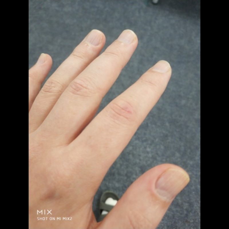 Nail Segmenter Instance Segmentation Dataset and Pre-Trained Model by rizqi