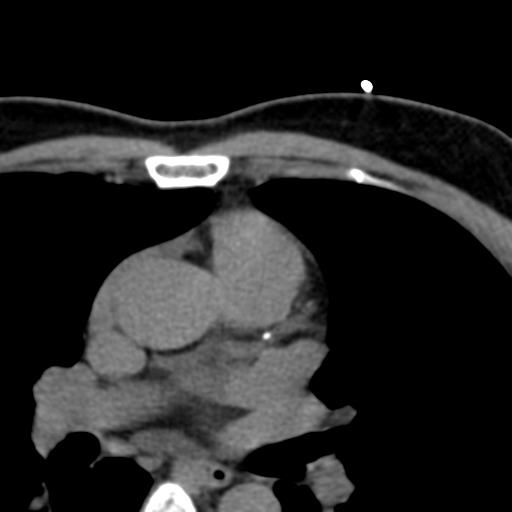 How to Use the detr Instance Segmentation API