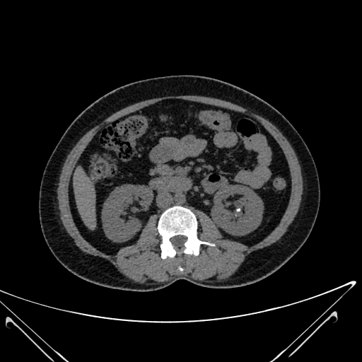 Stone Detection Object Detection Dataset and Pre-Trained Model by East ...