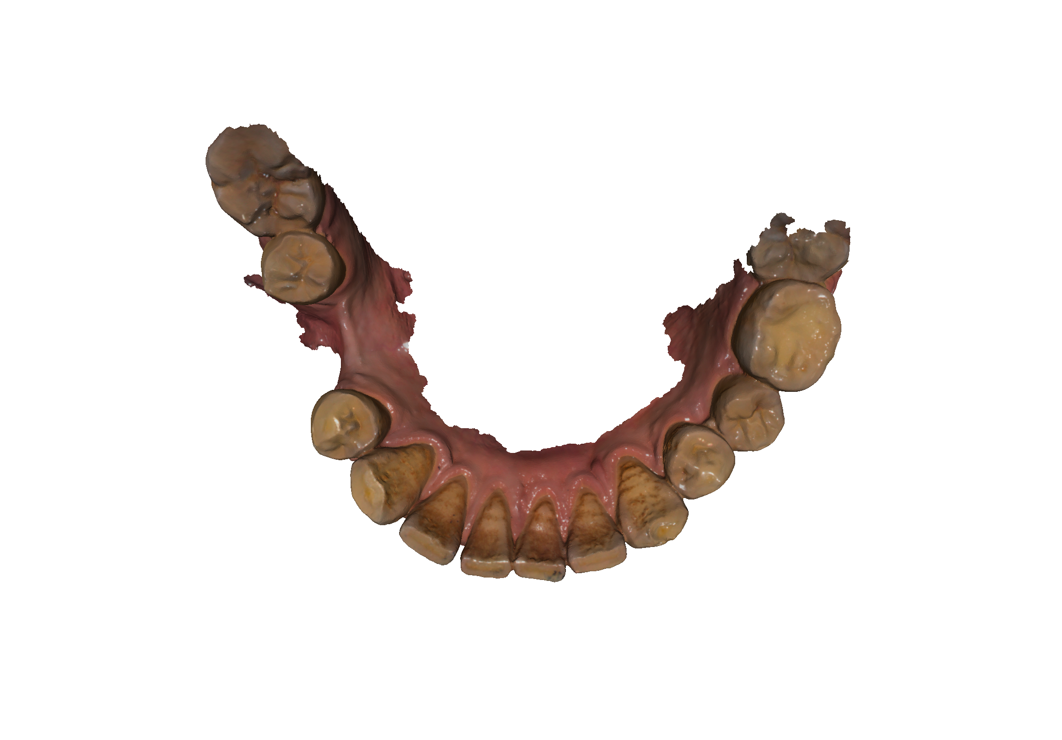 tooth Object Detection Dataset by my place