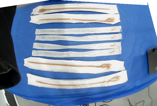 Catheter Us 18 Oct 1 Object Detection Dataset V1 2023 10 19 12 21am By Mirinae