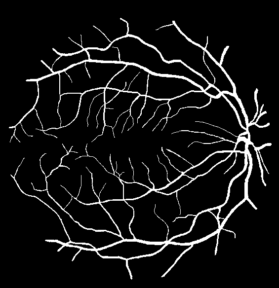 Vessel_tree Object Detection Dataset by Steffen Cantillo