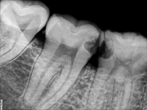 IOPA Object Detection Dataset by dentai