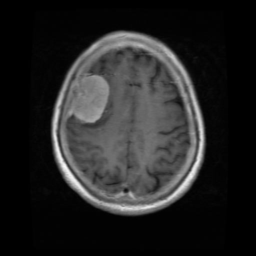 glima Object Detection Dataset and Pre-Trained Model by matana university