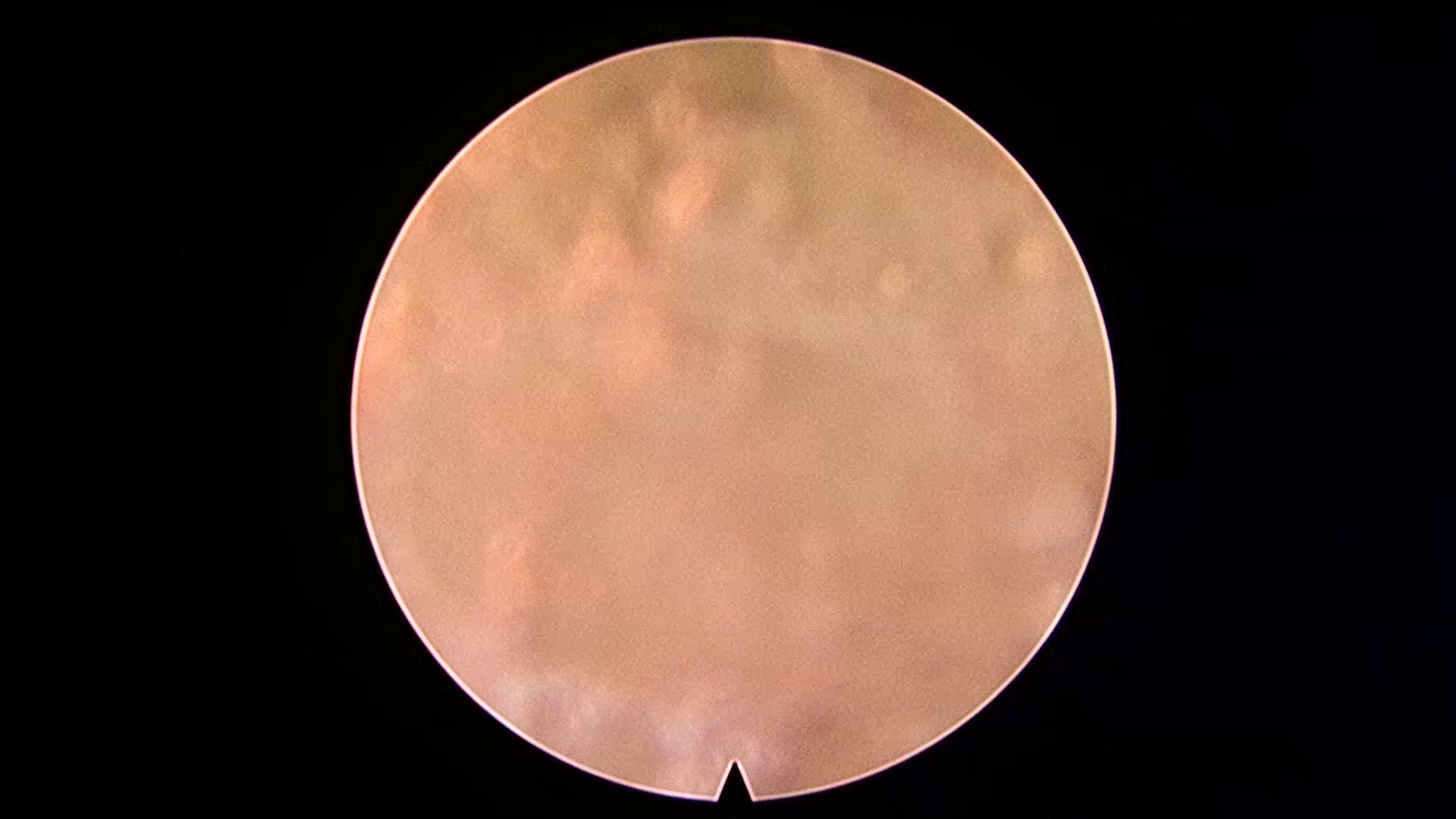 Endoscope Spine Surgery Object Detection Model by Spine Endoscope surgery