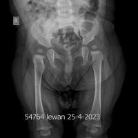 Trending Computer Vision Datasets - Roboflow Universe