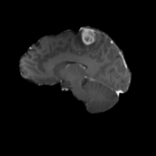 Brains reverse 1st Object Detection Model by ElbrusAlice