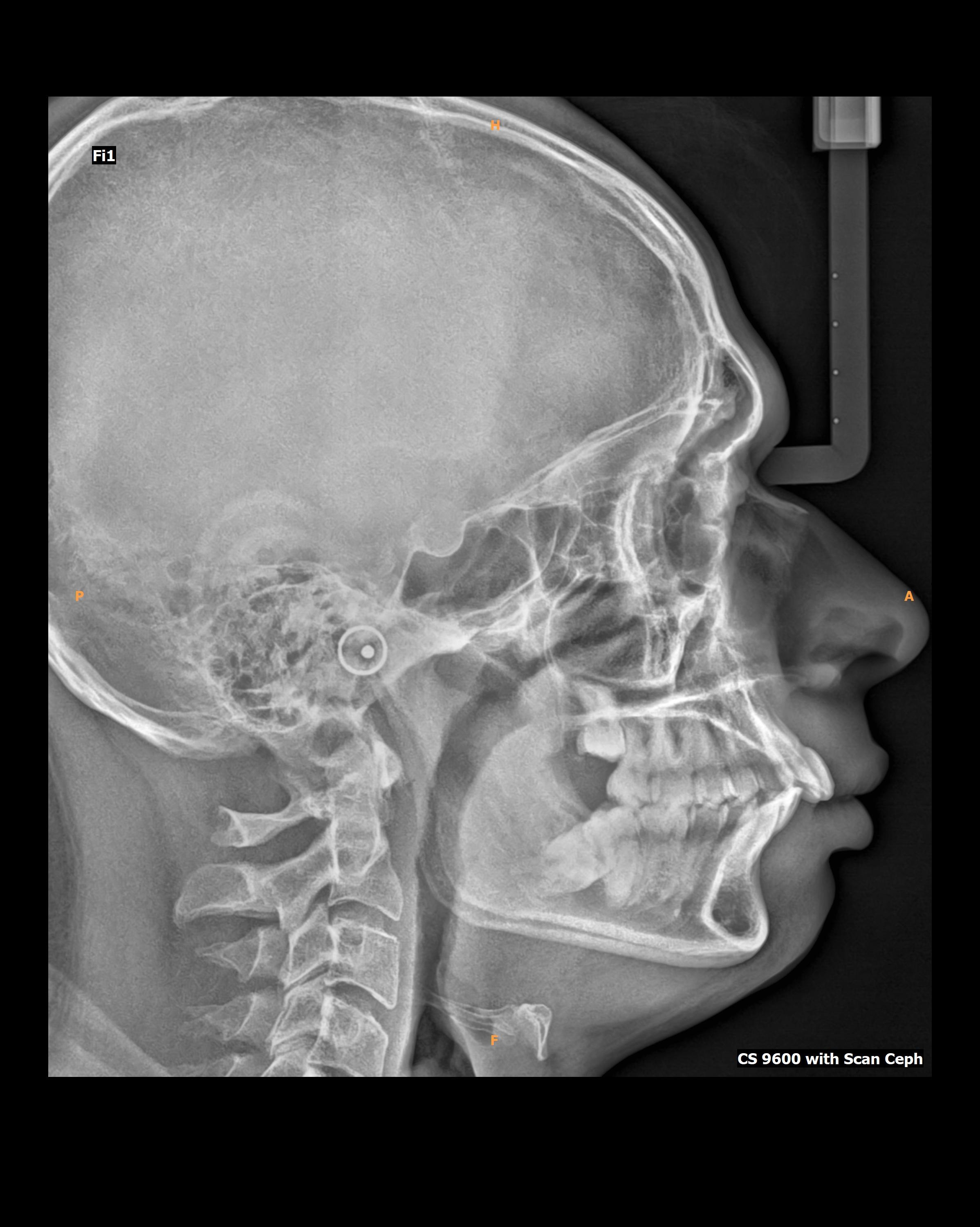 OPG (opg-3ltwt) - Roboflow Universe
