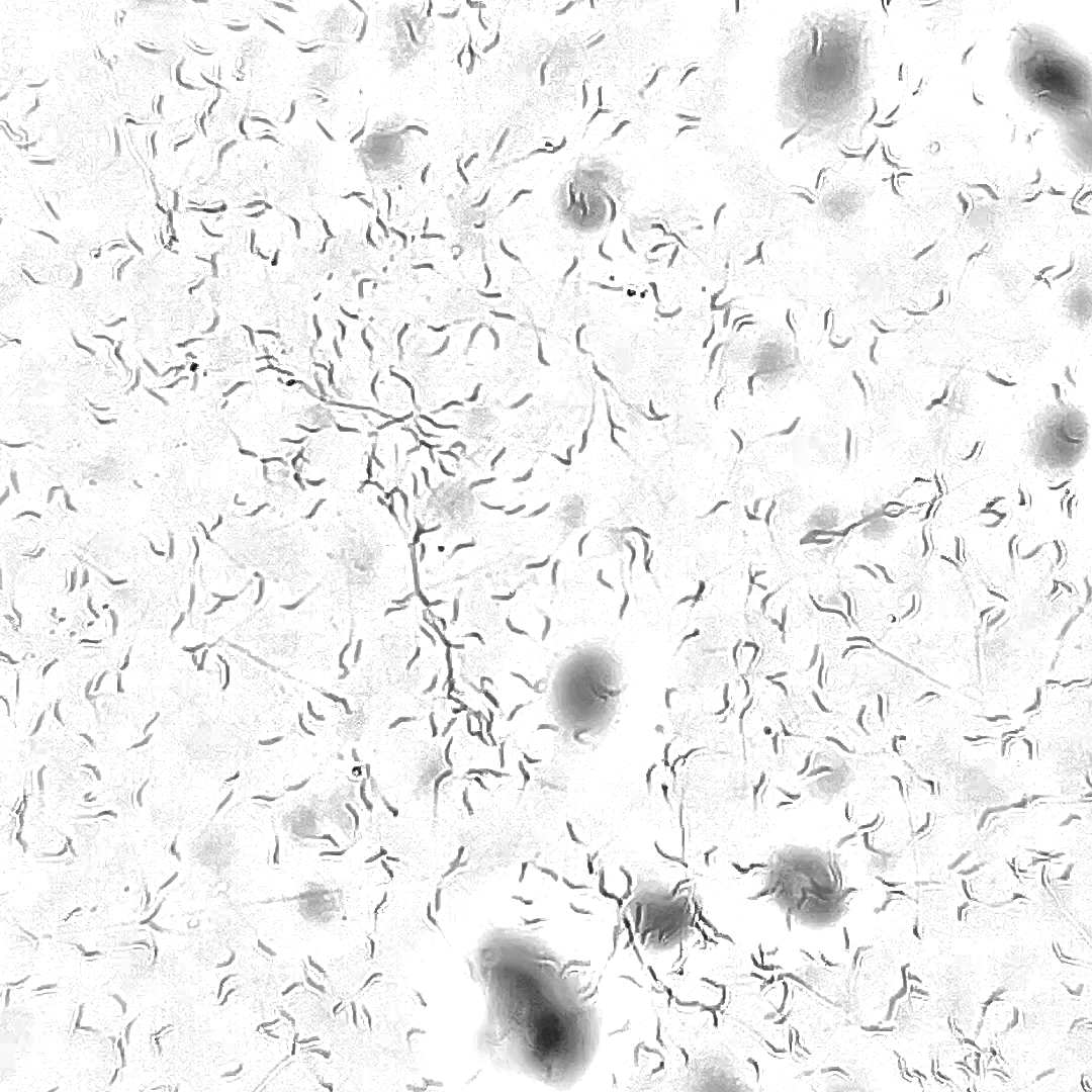 Sperm_ID Object Detection Dataset by SpermTracking