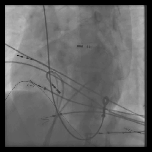 heart labeld Instance Segmentation Dataset and Pre-Trained Model by uni