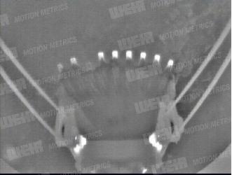 teeth health Instance Segmentation Dataset and Pre-Trained Model by ...