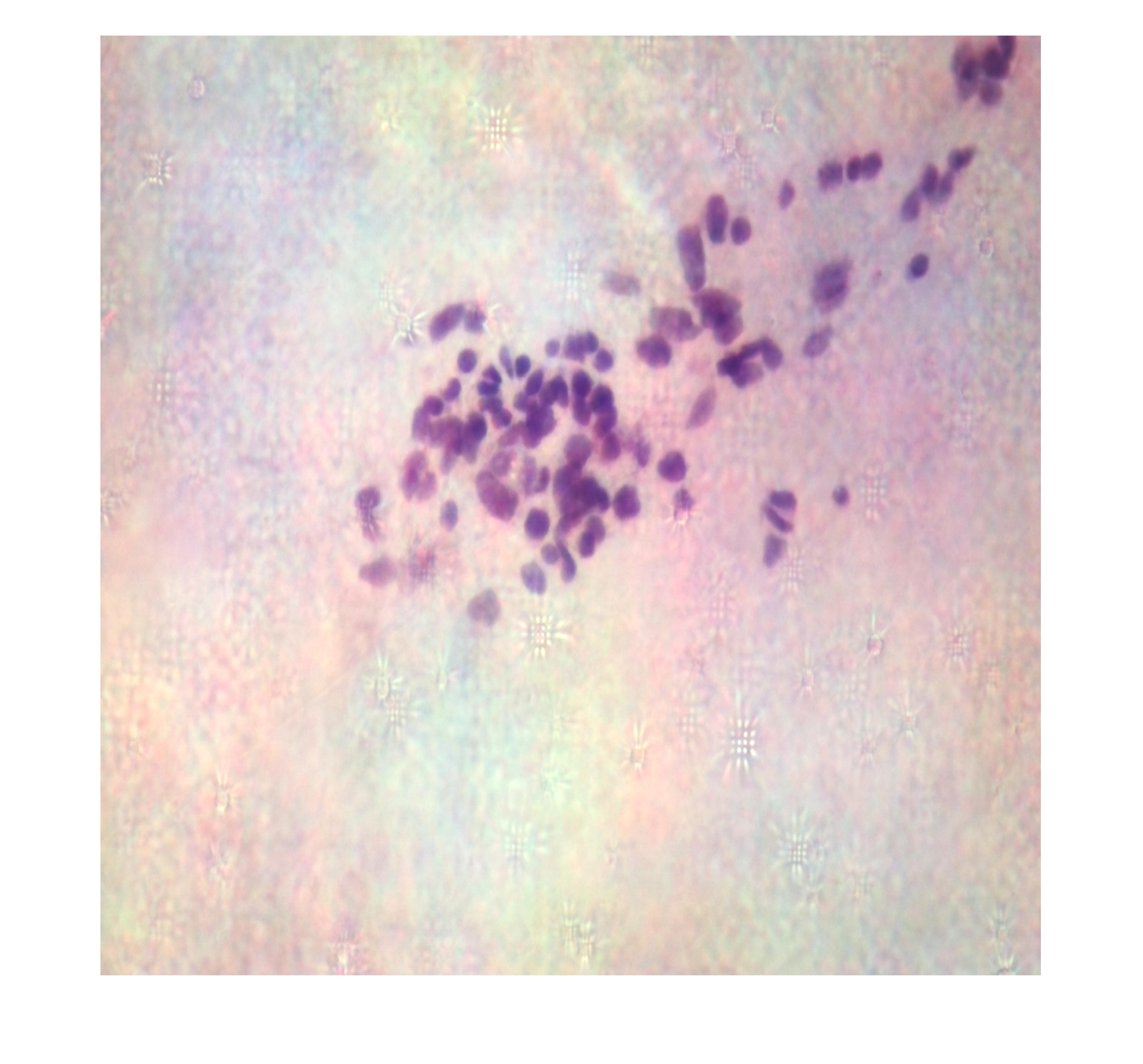 frcnn Object Detection Dataset by yolo5 dataset